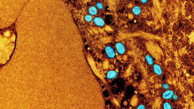 Elhuyarren gomendioak - Elhuyar Hiztegia